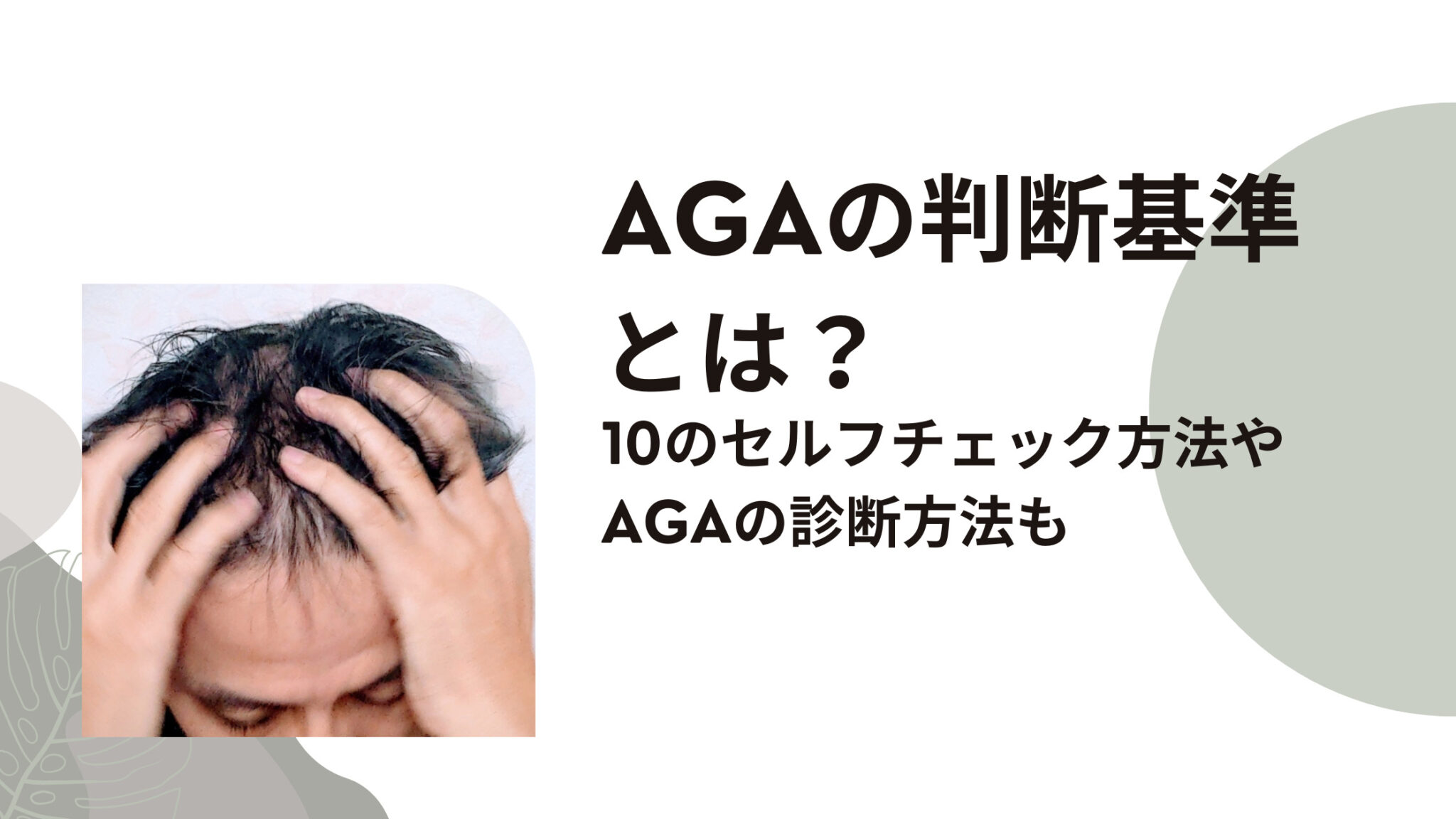 AGAのサイン・判断基準とは？10のセルフチェック方法やAGAの診断方法を解説！ - 診療比較ナビ