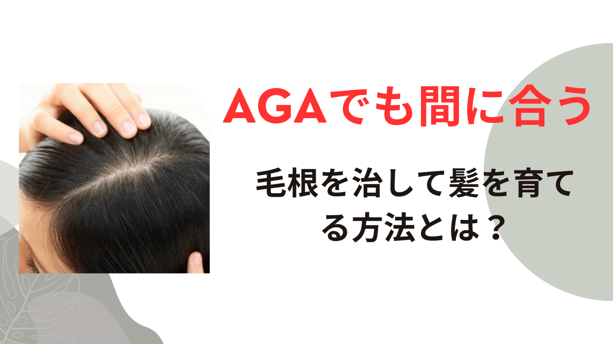 【徹底解説】AGA治療を皮膚科でするときに絶対しておくべき4つのこと - 診療比較ナビ